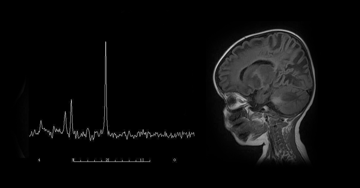 What Is An MR Spectroscopy And How Did It Change A Boy’s Future
