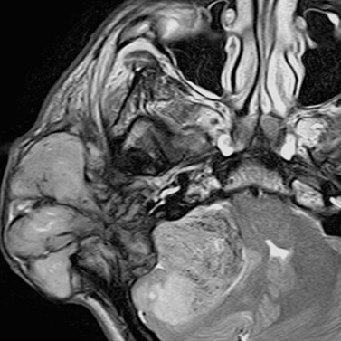 Best Diagnostic Centre Pune | MRI CT Scan | Star Imaging India