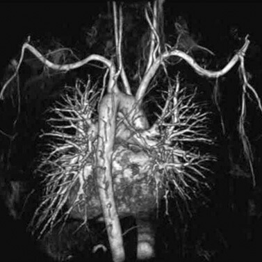 Best Diagnostic Centre Pune | MRI CT Scan | Star Imaging India