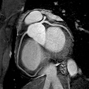 Best Diagnostic Centre Pune | MRI CT Scan | Star Imaging India