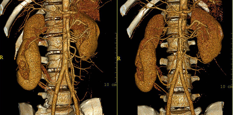 Best Diagnostic Centre Pune | MRI CT Scan | Star Imaging India