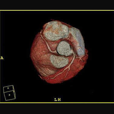 Best Diagnostic Centre Pune | MRI CT Scan | Star Imaging India