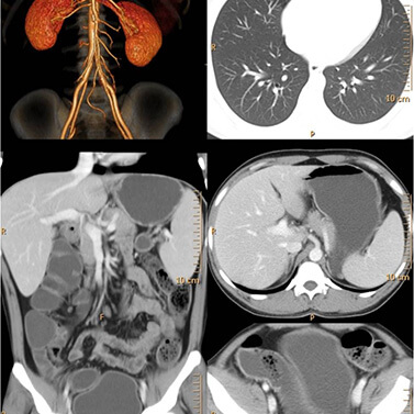 Best Diagnostic Centre Pune | MRI CT Scan | Star Imaging India