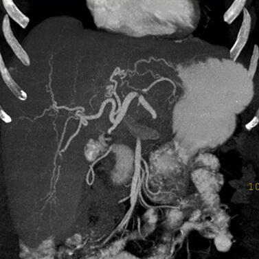 Best Diagnostic Centre Pune | MRI CT Scan | Star Imaging India