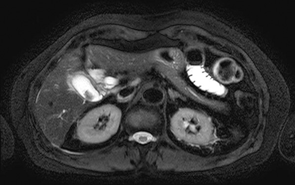Best Diagnostic Centre Pune | MRI CT Scan | Star Imaging India