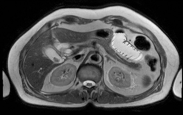 Best Diagnostic Centre Pune | MRI CT Scan | Star Imaging India