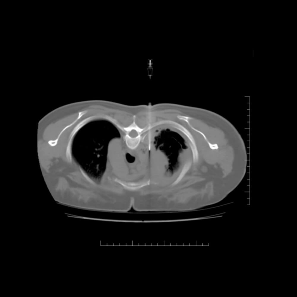 Best Diagnostic Centre Pune | MRI CT Scan | Star Imaging India