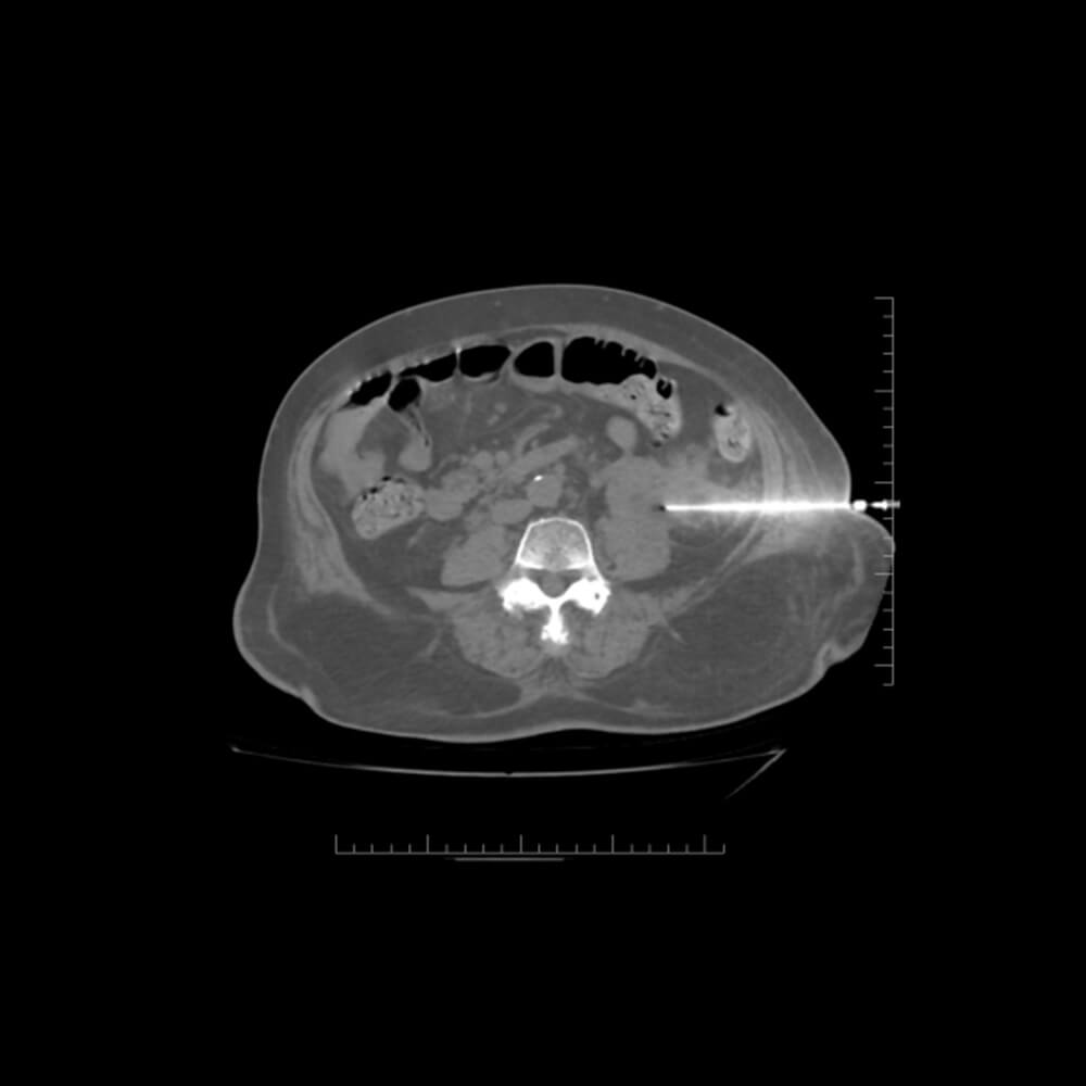 Best Diagnostic Centre Pune | MRI CT Scan | Star Imaging India