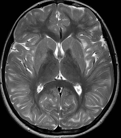 Best Diagnostic Centre Pune | MRI CT Scan | Star Imaging India