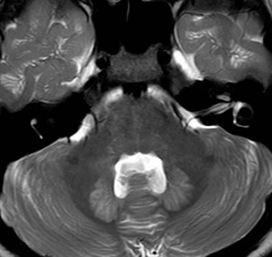 Best Diagnostic Centre Pune | MRI CT Scan | Star Imaging India