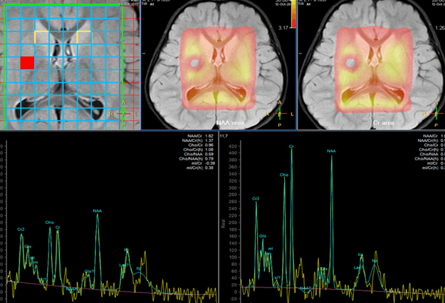 Best Diagnostic Centre Pune | MRI CT Scan | Star Imaging India