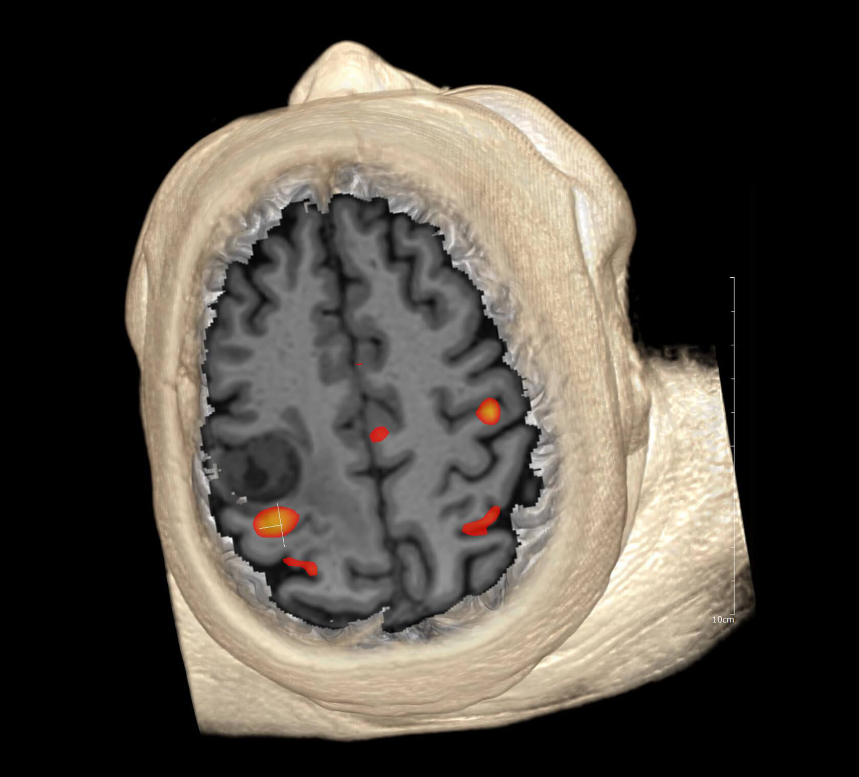 Best Diagnostic Centre Pune | MRI CT Scan | Star Imaging India