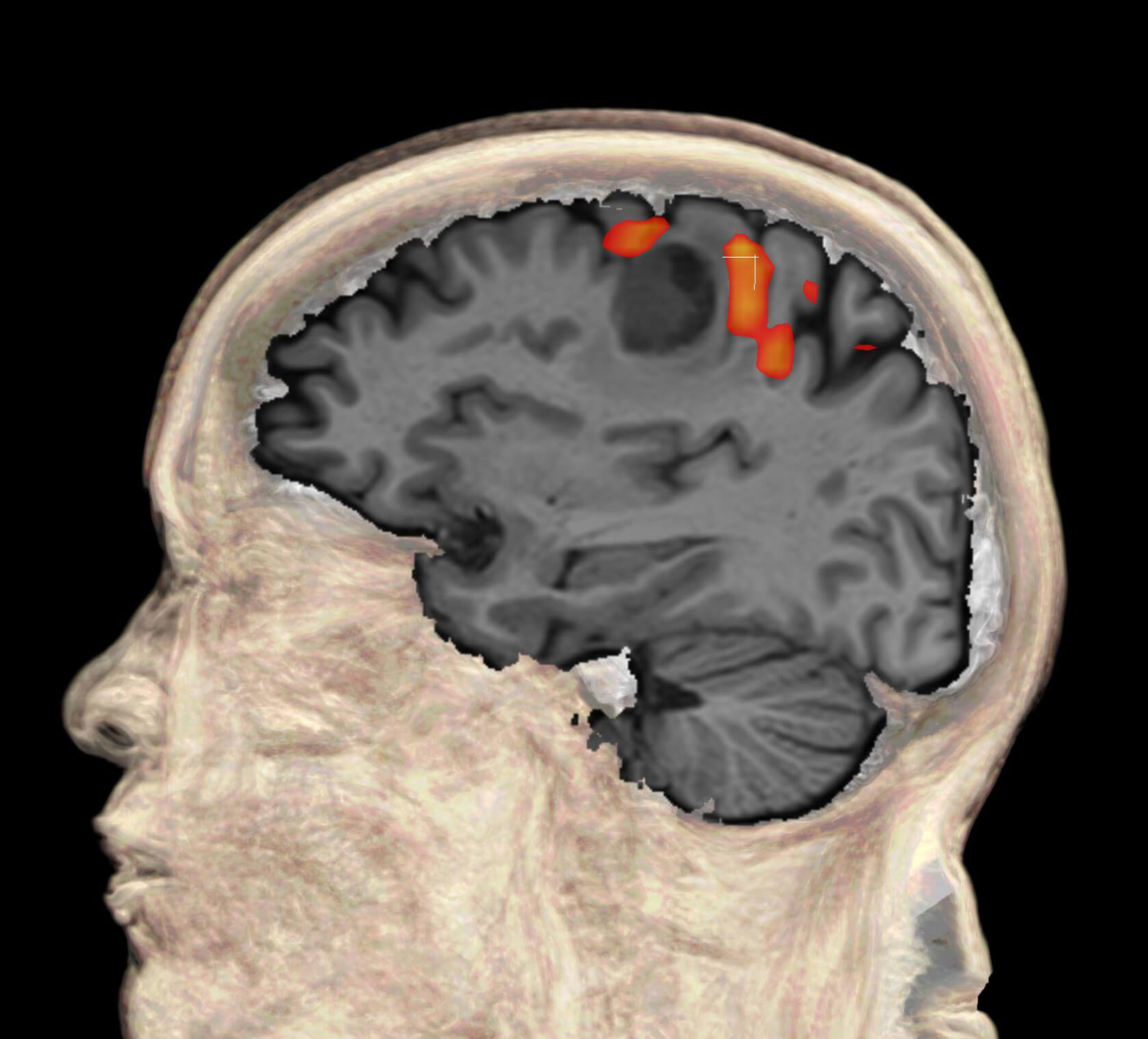 Best Diagnostic Centre Pune | MRI CT Scan | Star Imaging India