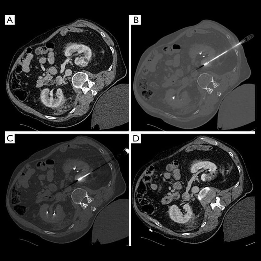 Best Diagnostic Centre Pune | MRI CT Scan | Star Imaging India
