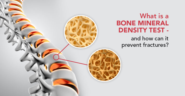 What is a Bone Mineral Density Test – and how can it prevent fractures?